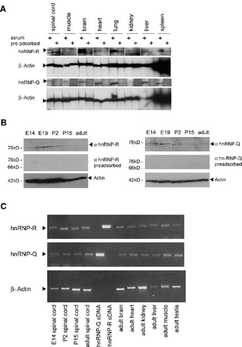 Tissue Distribution And Developmental Regulation Of Hnrnp R And Hnrnp Q Download Scientific