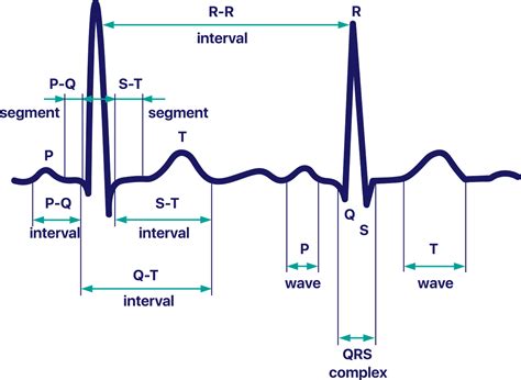 Ecg Waveform