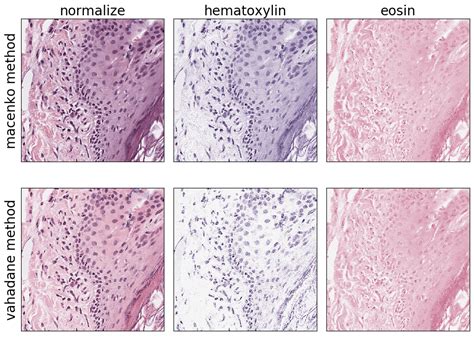 Hande Stain Deconvolution And Color Normalization — Pathml 211 Documentation