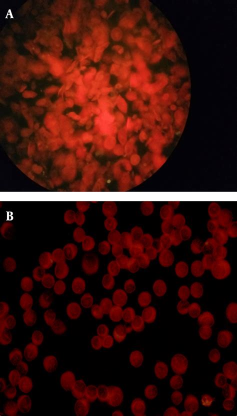 A Negative Sample For Human Metapneumovirus Hmpv By Dfa Assay Download Scientific Diagram