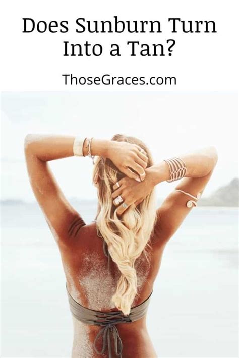 Does Sunburn Turn Into A Tan Everything You Need To Know ThoseGraces Com