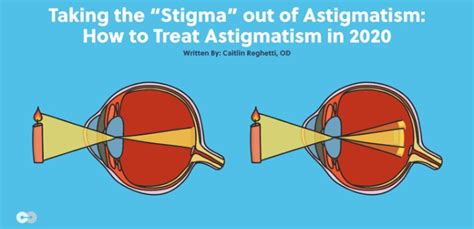 Signs And Symptoms Of Astigmatism Optography