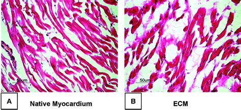 Tissue Engineered Myocardial Patch Derived From Extracellular Matrix