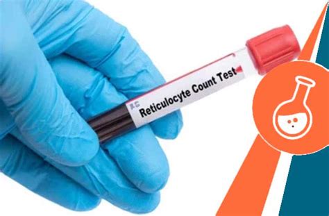 Reticulocyte Count Reticulocytosis Book Retic Count Rs 300 Healthcareontime