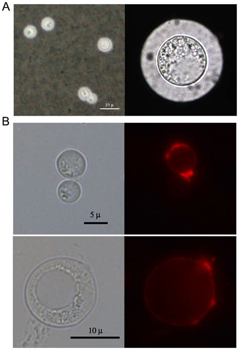 Cryptococcus Neoformans Forms Giant Cells In Galleria Mellonella A Download Scientific
