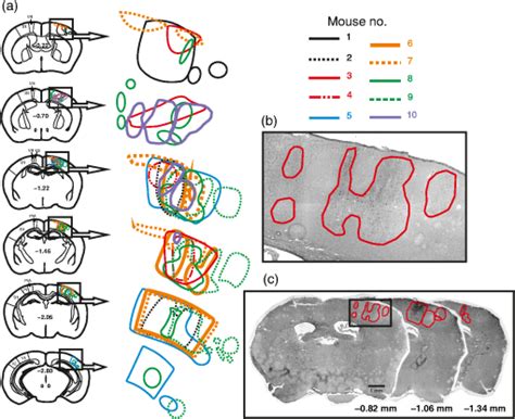 In Vivo Brain Imaging With Multimodal Optical Coherence Microscopy In A Mouse Model Of