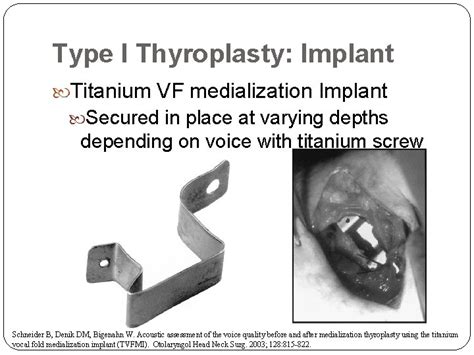 Medialization Thyroplasty Jennifer Bergeron April 11 2012 Introduction