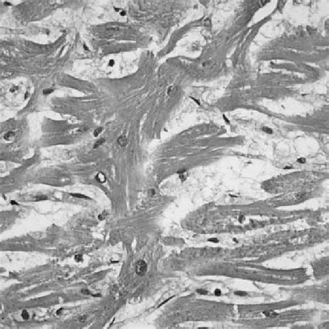 2 Typical Findings On Autopsy Of Histologic Examination Showing Download Scientific Diagram