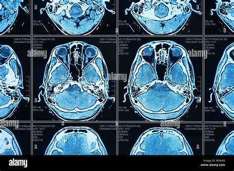 Artificial Intelligence In Smart Healthcare Hospital Technology Concept Ai Biomedical Algorithm