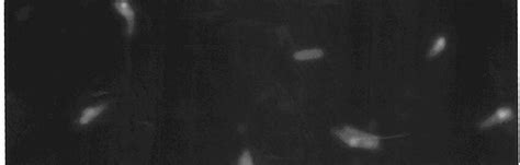 Epi Uorescent Photomicrograph Of B Subtilus Cells Captured In An