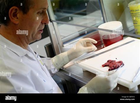 Tissue Sample Selection Thyroid Anatomic Pathology Onkologikoa Hospital