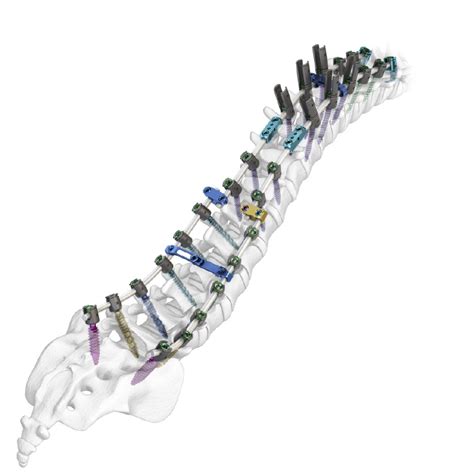 Spinal Fixation Devices Thoracolumbar Fixation Products