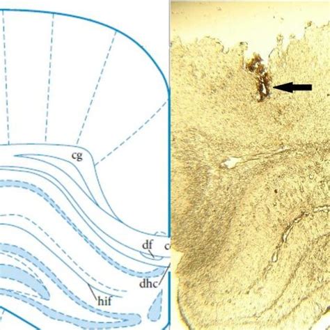 Histological Representations Of The Electrode Sites In The Parietal