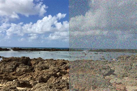 What Is Visual Snow Syndrome