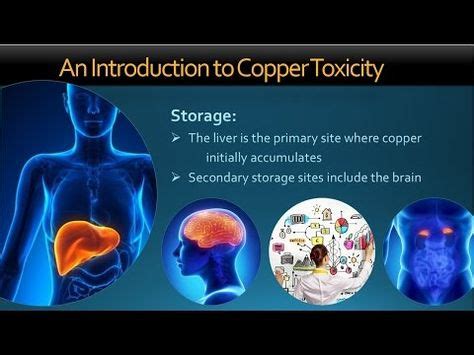 Copper Toxicity Ideas Copper Toxicity Health Info Health