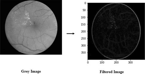 Filtered Image After Edge Detection Download Scientific Diagram