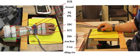 Sensors Placement Edc Extensor Digitorum Communis Ecu Extensor Download Scientific Diagram