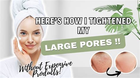 How To Get Rid Of Large Pores Naturally YouTube