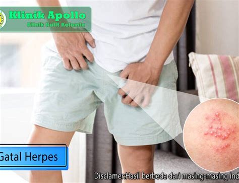 Memahami Warna Urine Yang Sehat Dan Abnormal Klinik Apollo Jakarta