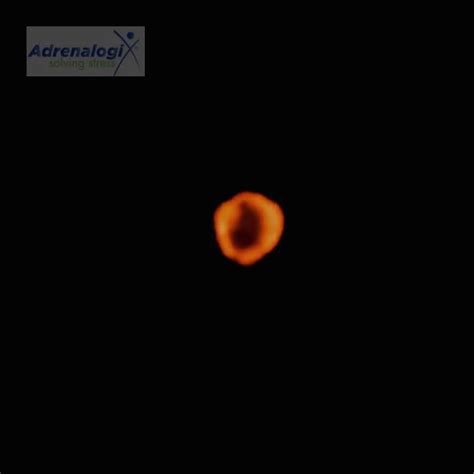 Filip Trpkovski On Linkedin Adrenafem Menopause