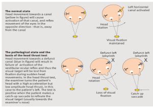 Cme 160114 Vestibular And Vertigo Assessment Charlies Ed