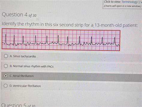 Identify The Rhythm In This Six Second Strip