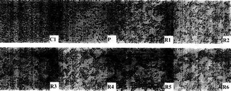 Recombinant Ganoderma Lucidum Immunoregulation Protein With Antineoplastic Function And
