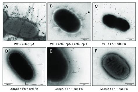Binding Of Fn To Epec Negative Staining And Immunogold Labeling Of