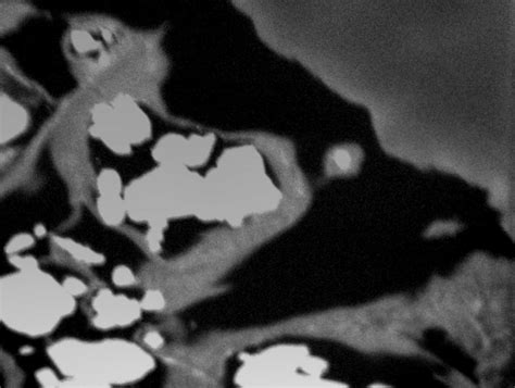 LV SEM Image Segmented Using Trainable Weka Segmentation A