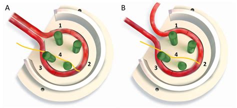 A Comparison Between The Newly Modified A And The Previously Download Scientific Diagram