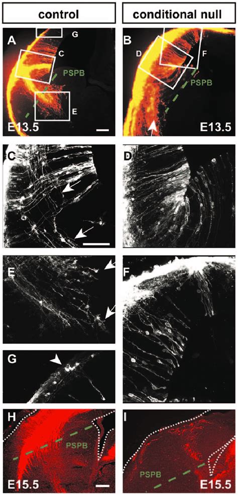 Cortex Specific Deletion Of Apc Prevents The Production Of Descending Download Scientific