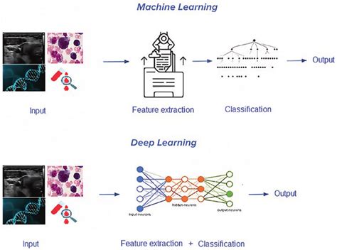 1 Difference Between Ml And Dl In Contrast To Ml Dl Does Not Need To