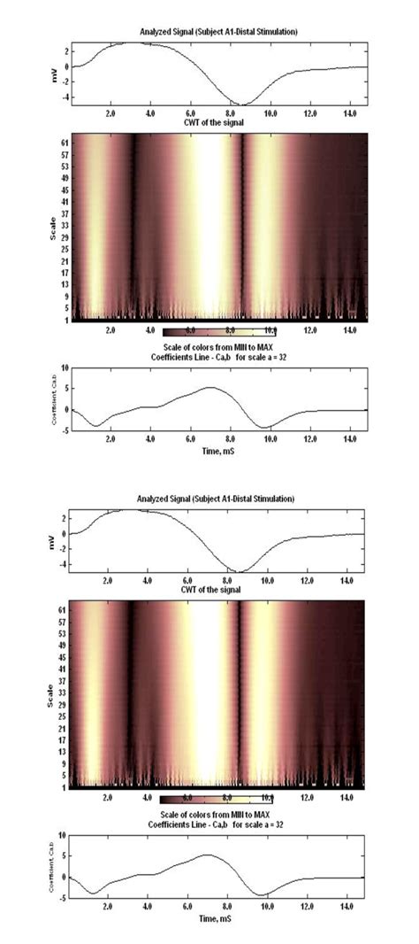 cwt with coefficient line variations of cmap signals from a normal