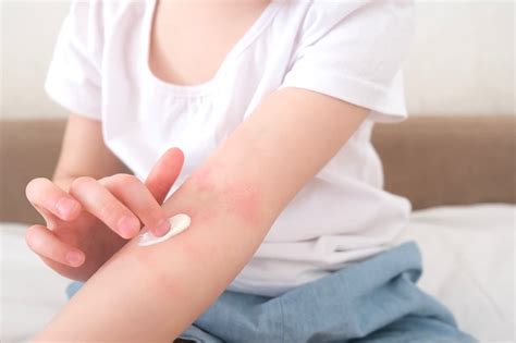 Plaster Allergy Causes And Symptoms What To Do If Youre Allergic To