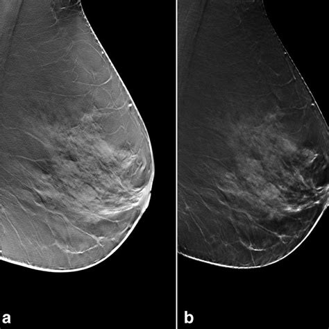 The Network Architecture Of Retinanet Retinanet Uses The Feature Download Scientific Diagram