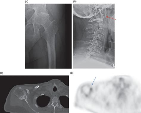 Musculoskeletal Imaging Radiology Key