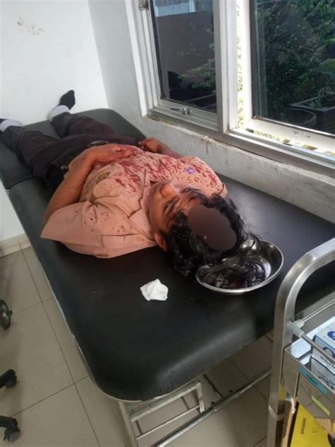 Pulang Sekolah 2 Pelajar Smp Dipukul Pakai Broti Di Galang