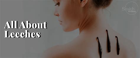 Can Leeches Be Used To Predict The Weather Visiting Australia