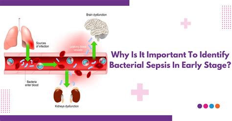 Why Is It Important To Identify Bacterial Sepsis In Early Stage Sri