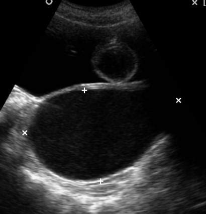 Image Radiopaedia Org