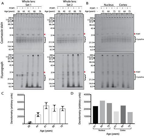 L IsoAsp Damage Accumulates With Age Throughout A Range Of Polypeptide Download Scientific
