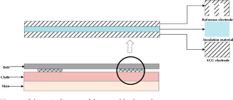 Figure 1 From Reduction In The Motion Artifacts In Noncontact Ecg