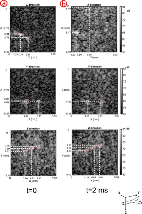 Figure 3 From Ultrafast 3 D Ultrasound Localization Microscopy Using A 32 × 32 Matrix Array