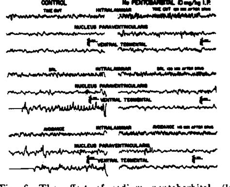 Figure 1 From Electroencephalographic Correlates Of Temporally Spaced Responding And Avoidance