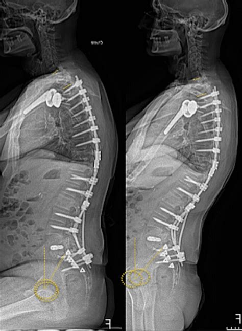 the figure shows an example of a patient evaluated in group a with the