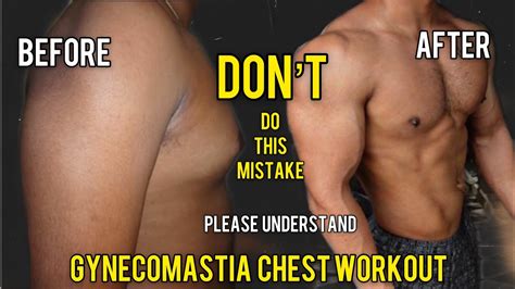 Chest Exercises To Get Rid Of Gyno At Isabella Embry Blog