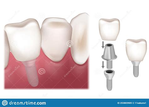 Tooth In Crown Cartoon Vector 195669759