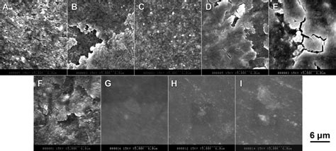 Representative Scanning Electron Microscopy Sem Photographs Of Worn