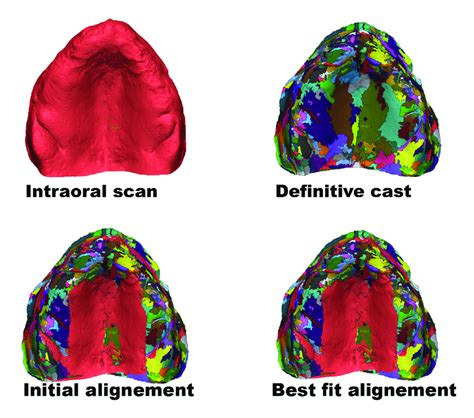 Alignment Sequence Between Intraoral Scan And Scan Of Definitive Cast