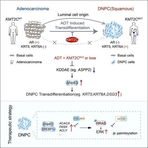Cancer Cell：秦骏 梁朝朝 袁怀瑞 董樑团队揭示双阴性前列腺癌耐药新机制 德州学院 生命科学学院